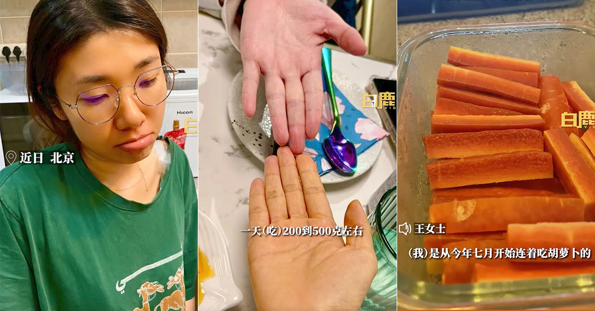 Woman Turns Orange After Eating Carrots Every Day For 3 Months To Lose ...