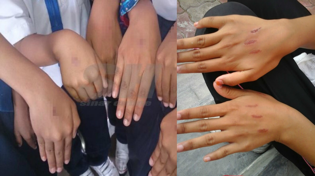 Trend Terbaru, Pelajar Sekolah Gores Tangan Sampai Berparut Sebab ...