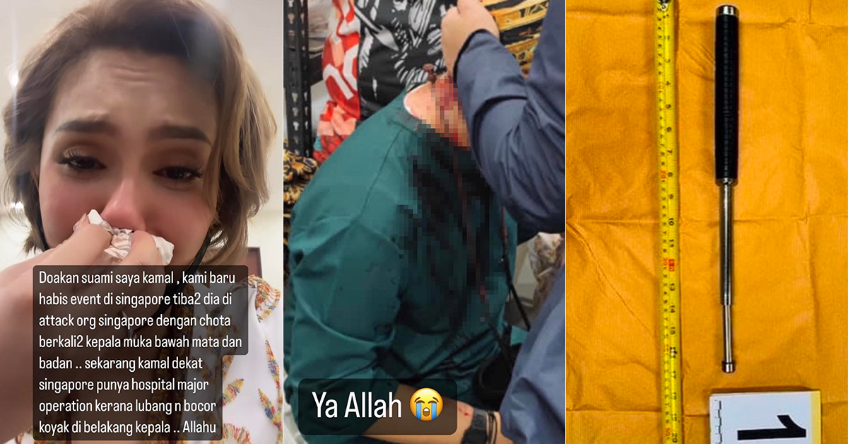 Local Actor Undergoes Surgery After Hate Attack By Baton-Wielding Man ...