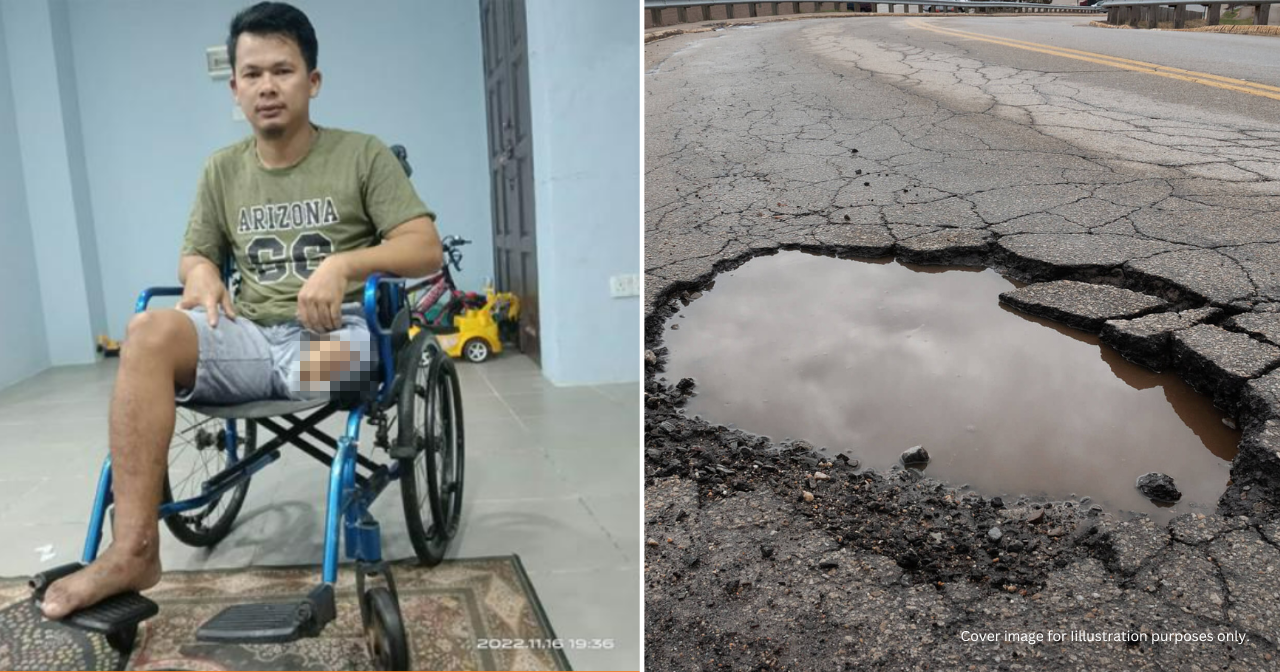 Man Who Lost His Leg After Falling Into Pothole Gets RM652,000 As ...