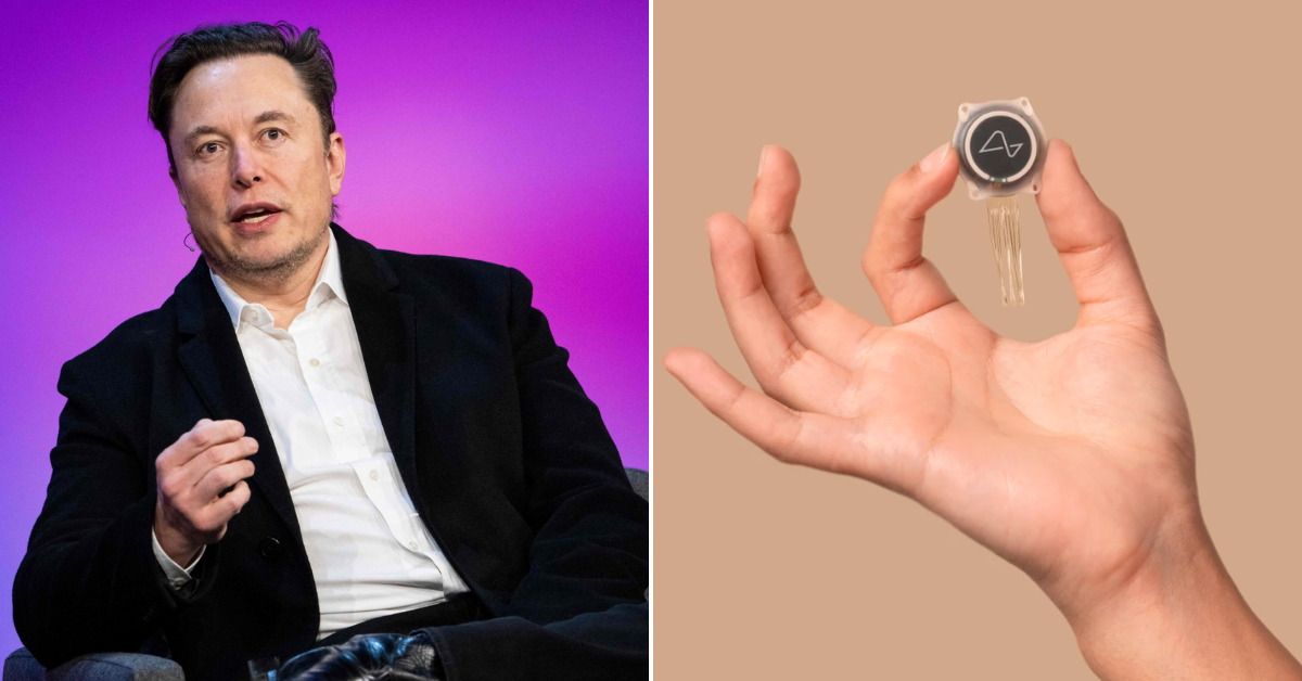 Elon Musk’s Company Has Implanted A Brain Chip In A Human