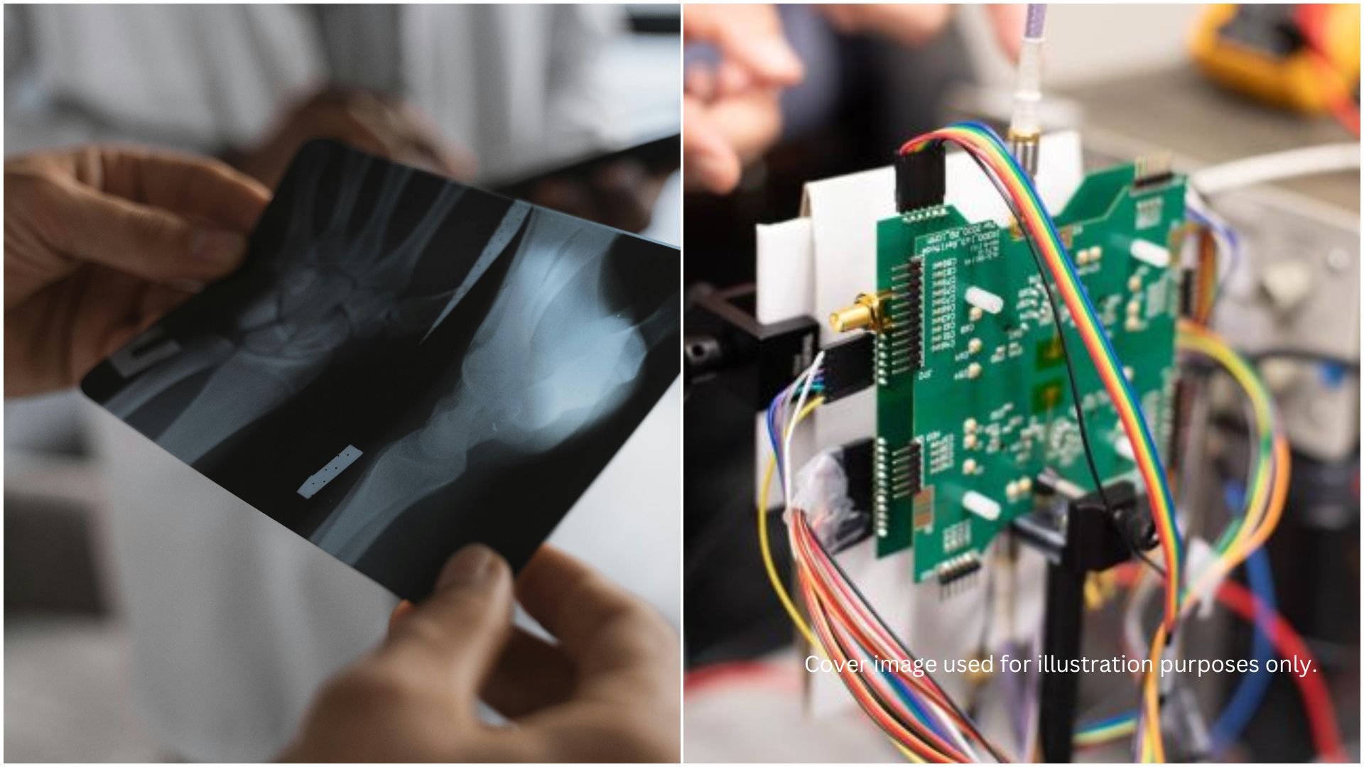 Scientists Invent X-Ray Lenses For Your Smartphones To ‘See’ Through Walls