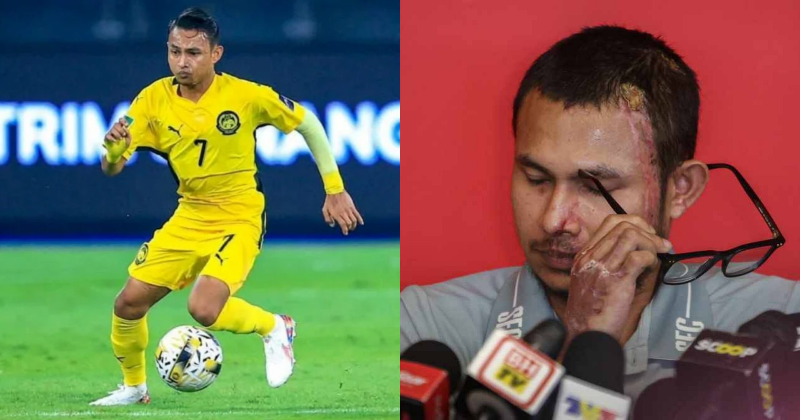 Kes Faisal Halim Disimbah Asid Diklasifikasi Sebagai “Tiada Tindakan ...