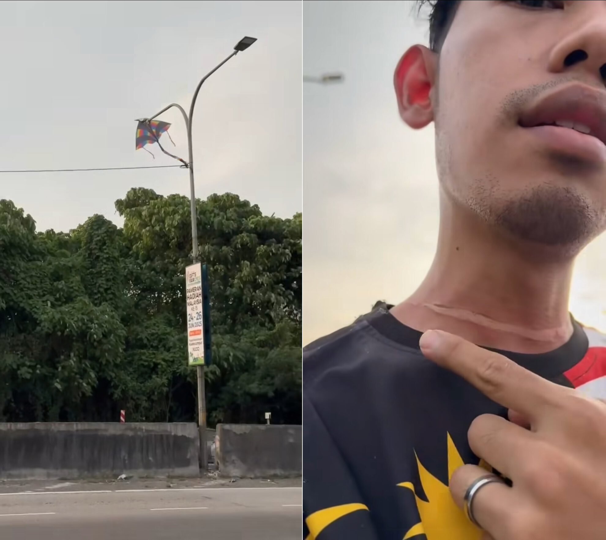 Motorcyclist Shares Warning After Kite String Slashes His Neck While ...