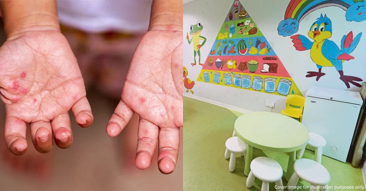 Malaysia Sees 266% Surge In HFMD Cases This Year. These 3 States Are ...