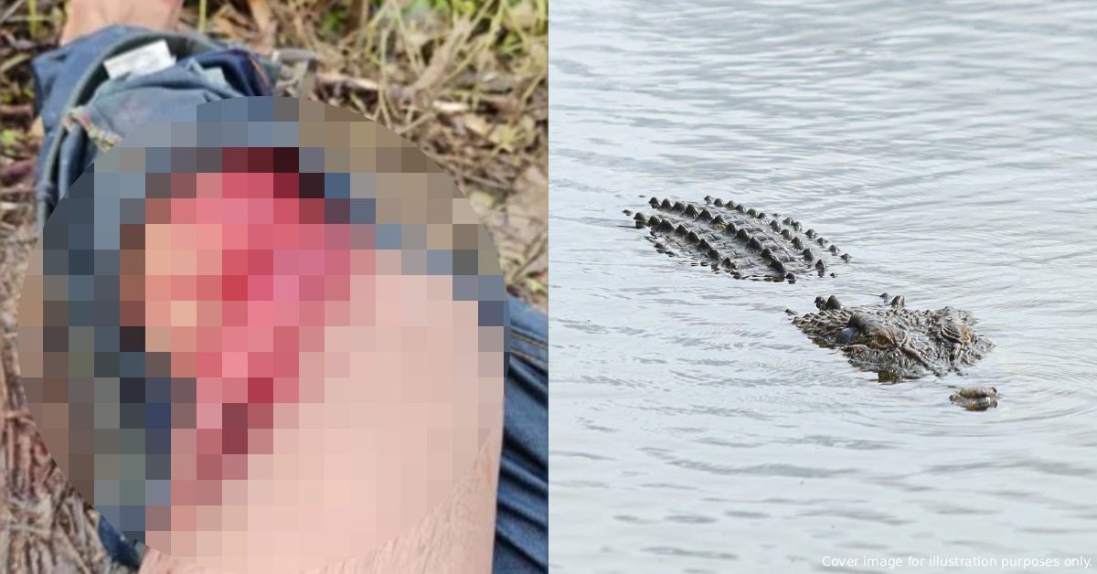Man Injured After Attack By Crocodile That Entered Village Through ...